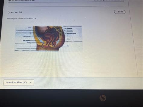 Solved Identify The Structure Labeled Identify The Chegg