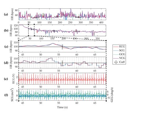Real Time Cardiac Beat Detection And Heart Rate Monitoring From Combined Seismocardiography And