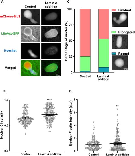 Nuclear F Actin And Lamin A Antagonistically Modulate Nuclear Shape