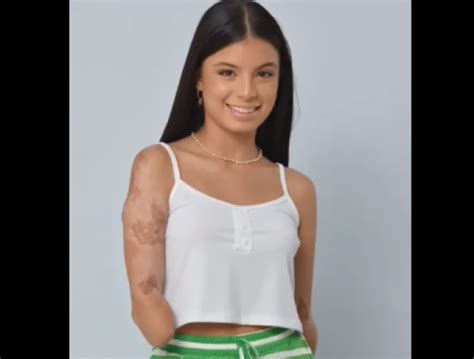 La Historia De La Deportista Que Modela Y Sueña Con Tener Brazos