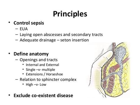 Fistula In Ano