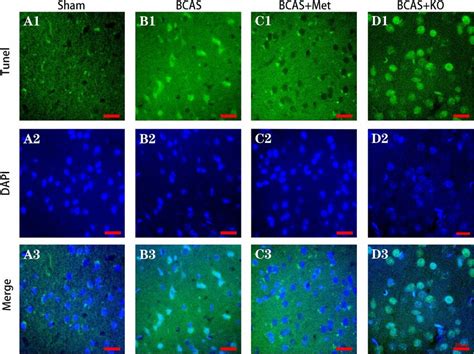 Apoptosis In The Cerebral Cortex Cells Of Mice In 3 Months After The