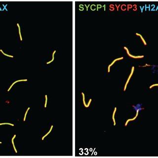 Sex Body Formation In The Prdm PWD F Hybrid Male Surface Spread Download Scientific