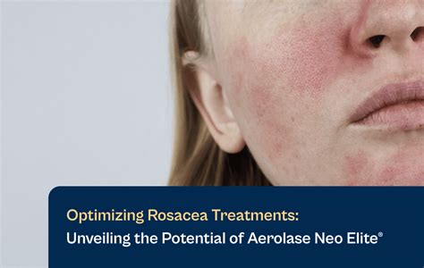 Optimizing Rosacea Treatment Unveiling The Potential Of Aerolase Neo Elite