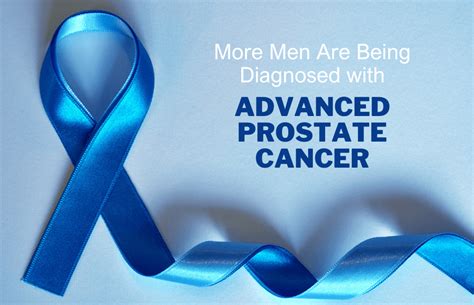 More Men Are Being Diagnosed With Advanced Prostate Cancer