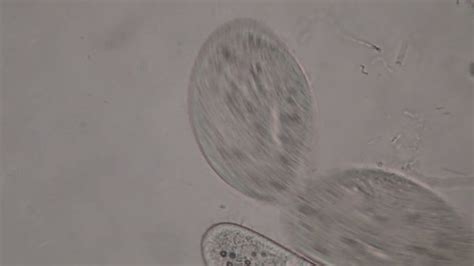 Binary Fission Paramecium