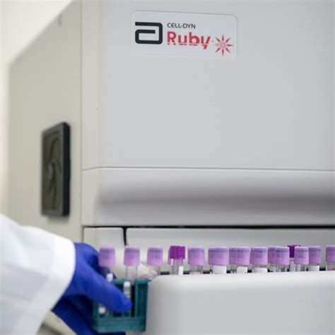 适用于中等业务量实验室的 Cell Dyn Ruby 血液学系统 雅培核心实验室