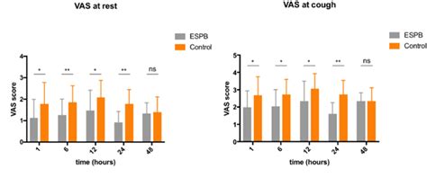 Figure 3 From Ultrasound Guided Erector Spinae Plane Block For