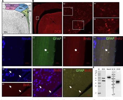 Figure 1 From The Hippocampus Of Birds In A View Of Evolutionary Connectomics Semantic Scholar