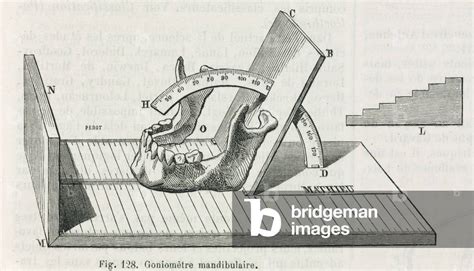 Image Of Heads Mandibular Goniometer 1883