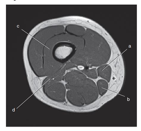 Diagram Of Axial Mri Of Distal Femur Quizlet