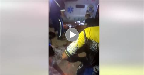 Video Motociclista Perdió Sus Piernas Al Tratar De Esquivar Un Hueco En Una Vía De Santander