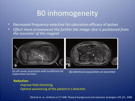 Distortion Artifacts In Mri And Their Correction Ppt Digital Audio
