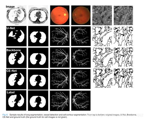 论文阅读笔记 医学图像分割 上下文编码网络 Ce Net论文里面的分割结果都是怎么显示的珏了的博客 Csdn博客