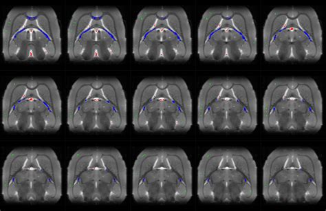 multi tissue csd preprocessing mrtrix3 community