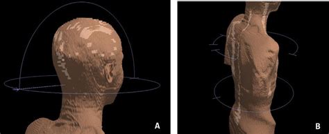 Vmat Dose Delivery Through 2 3 Sets With Separate Isocenter First Download Scientific Diagram