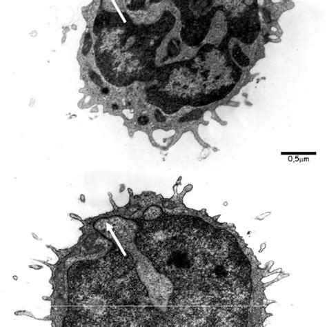 Characteristic Morphology Of B 1b Cells Cells Were Characterized As