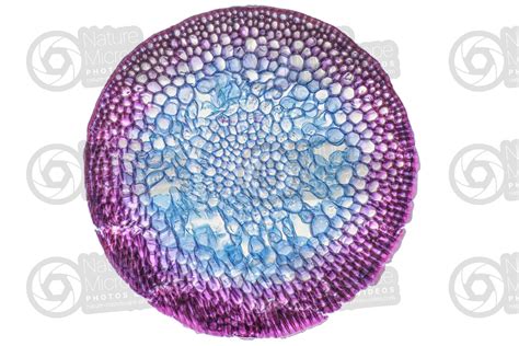 Polytrichum Sp Seta Transverse Section 250x Polytrichum Sp