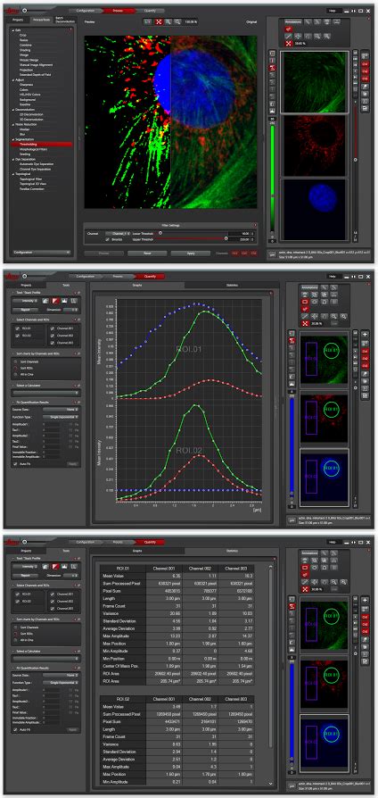 Leica Las X Wolfson Bioimaging Facility University Of Bristol