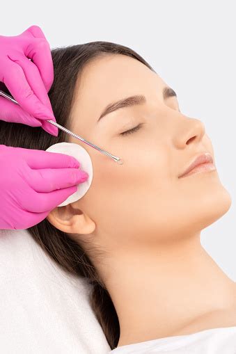 블랙 헤드와 여드름에서 얼굴의 피부를 정화하기위한 절차 미용실에서 미용실에서 젊은 여성의 얼굴의 문제가 있는 피부를 치료합니다 미용 미용 및 메이크업 컨셉 18 19세에