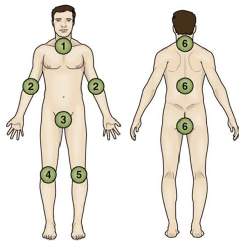 Tissue Integrity Flashcards Quizlet