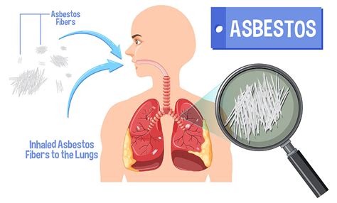The Risks Of Asbestos Exposure Armco Asbestos Training