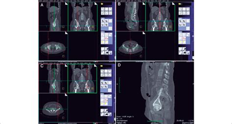 Selection Of Images In The Sagittal Plane From The Multiplanar Download Scientific Diagram