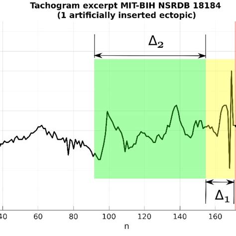 Pdf Automatic Near Real Time Outlier Detection And Correction In Cardiac Interbeat Interval