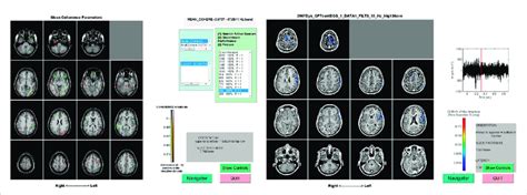 Representative Meg Scan Data From Two Different Studies The Image On Download Scientific