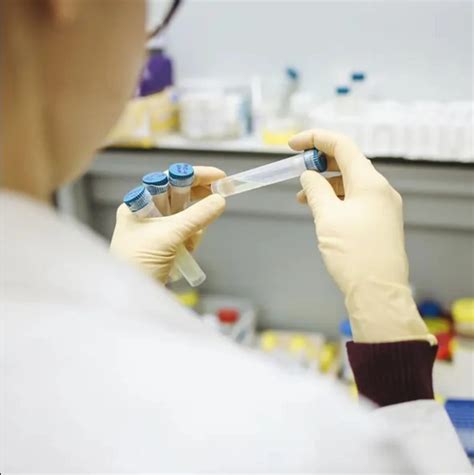 2025 Dot Random Testing Rates Easywaypro News