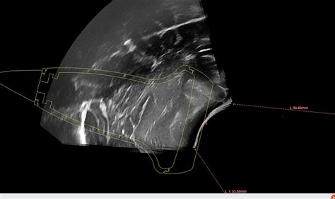 Clipping 2d Slices In An Arbitary Shape Support 3d Slicer Community