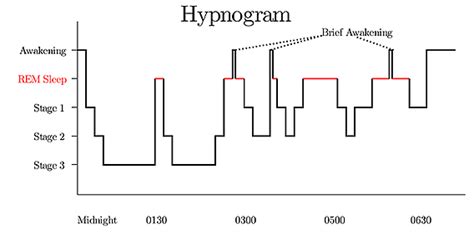 Hypnogram Updated « Sound Sleep Health