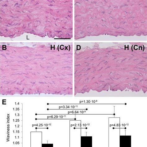 Transverse Sections Of The Ascending Aorta Convexity Cx A B And Download Scientific Diagram