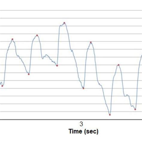 A Continuous Icp Signal Measured From An Icp Sensor Placed In The Download Scientific Diagram