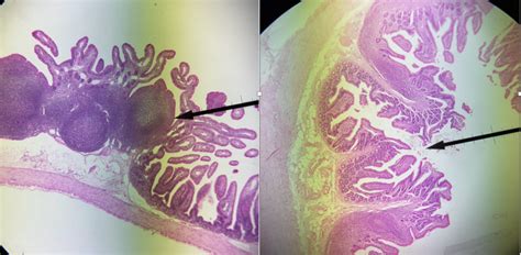 Ilium Histology Diagram Quizlet