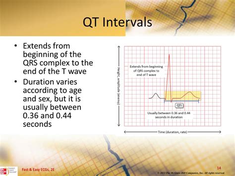 Ppt St Segments T Waves Qt Intervals And U Waves Powerpoint Presentation Id7068789 Ppt St Segments T Waves Qt Intervals And U Waves Powerpoint Presentation Id7068789