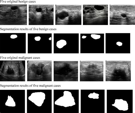 original and segmented images download scientific diagram