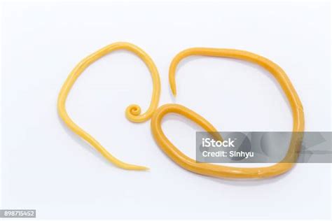 Ascariasis Adalah Penyakit Yang Disebabkan Oleh Cacing Gelang Parasit Ascaris Lumbricoides Untuk