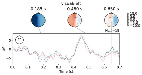 eeg complexity analysis — neurokit2 0 2 11 documentation