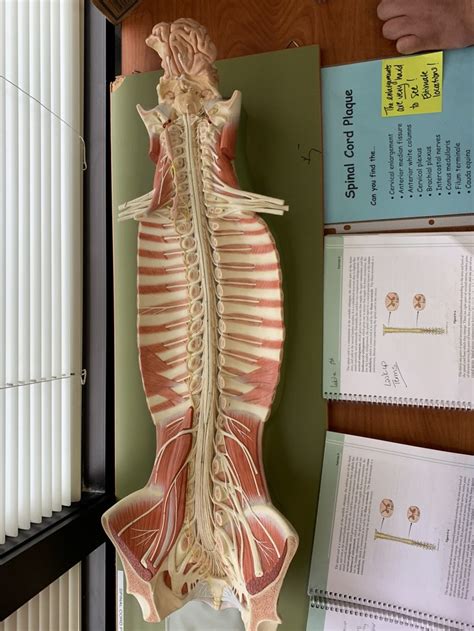 Lab Exercise 9 Objective 5 Diagram Quizlet