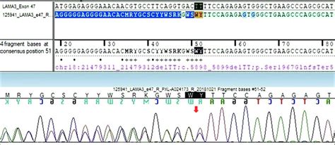 Sequence Chromatogram And Alignment To The Reference Sequence Showing