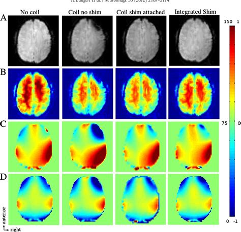 Figure 1 From Reducing Image Artefacts In Concurrent Tmsfmri By