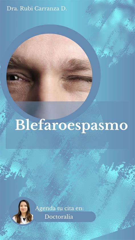 El Blefaroespasmo Es Una De Las Distonías Faciales Más Comunes 🧤sus Causas Pueden Ser 🧤una