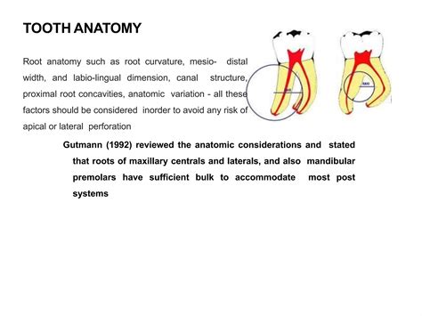 Post And Core PPTX Dental Health Diseases And Conditions