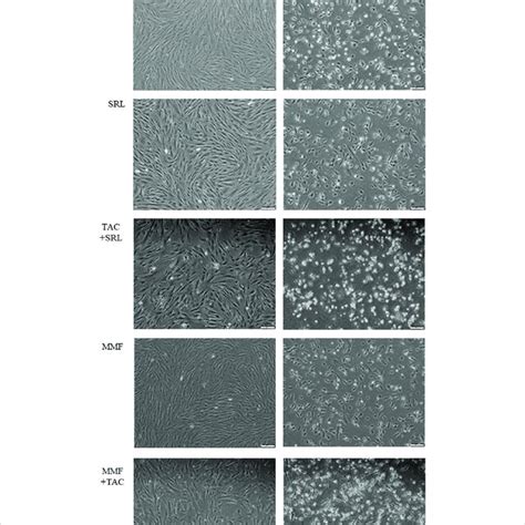 Examination Of The Hepatocyte Cultures Isolated From Human Cirrhotic Download Scientific