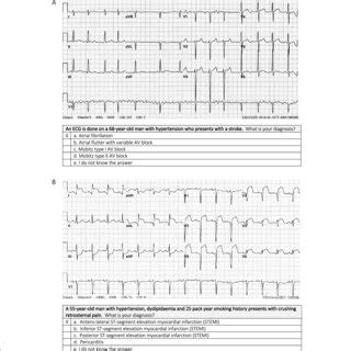 An Example Of The ECG Case Vignette And Multiple Choice Questions Download Scientific Diagram