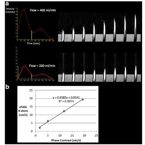 pulsatile flow phantom with flow velocities in the expected range for