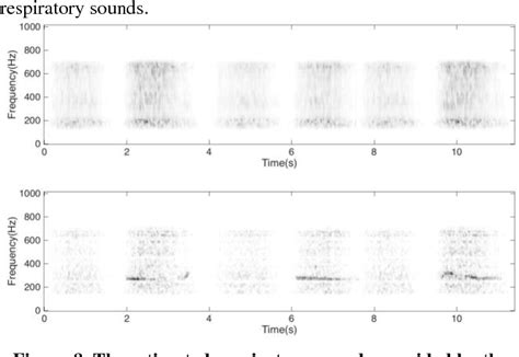 Figure 1 From Wheezing Sound Separation Based On Constrained Non