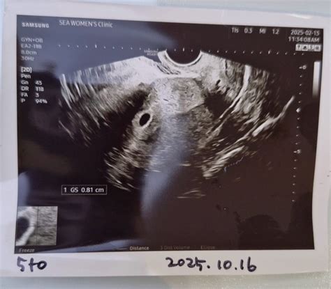 [일상]임신 초기부터 현재 21주 차까지 행복이 성별 공개 네이버 블로그