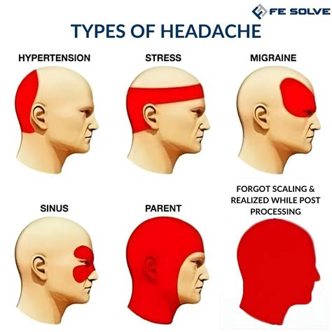 Fe Solve Engineering Services Pvt Ltd On Linkedin Fesolve Fea Engineering Geometryscaling